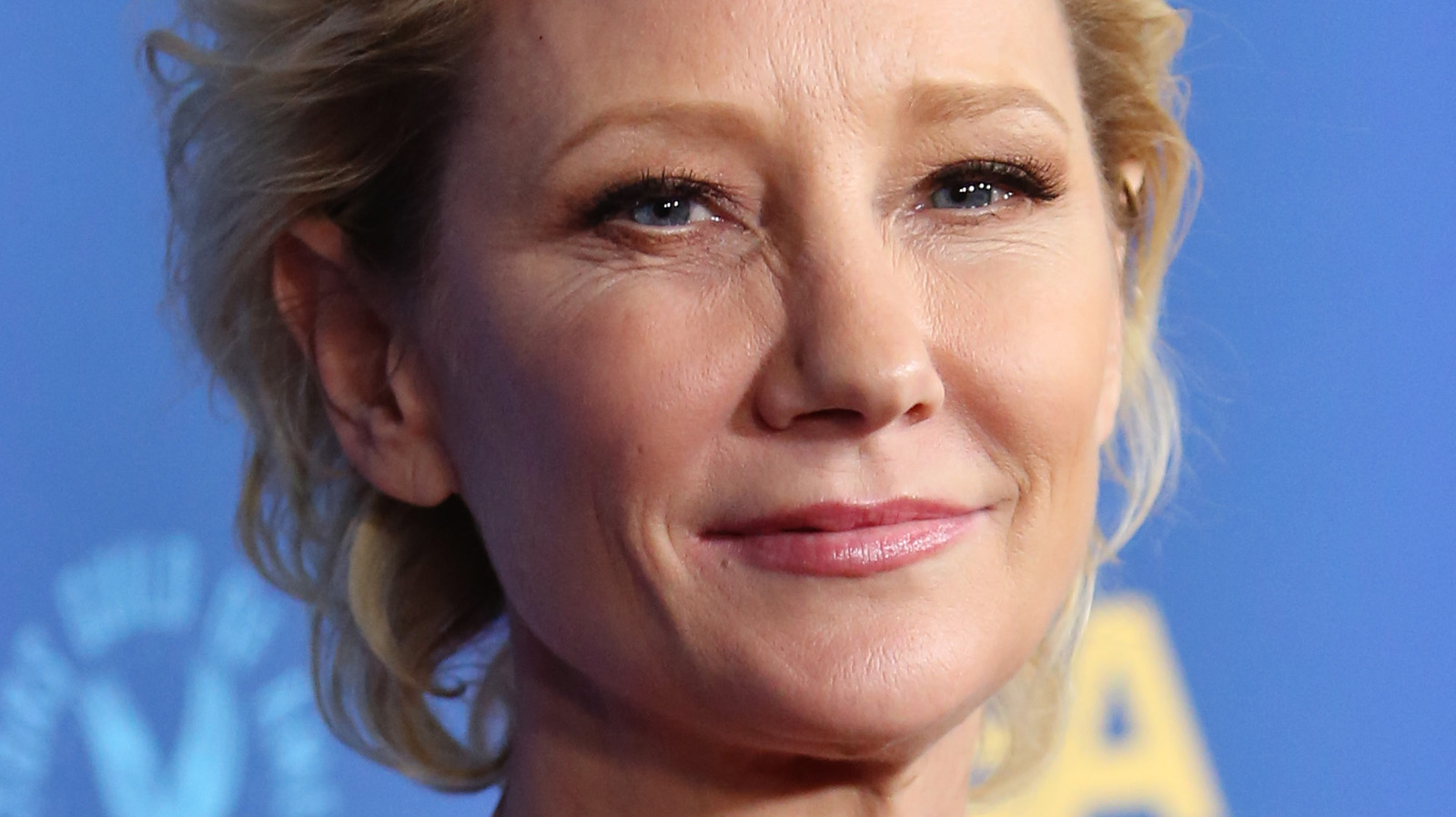 Anne Heche's Health Condition Takes Turn For The Worse