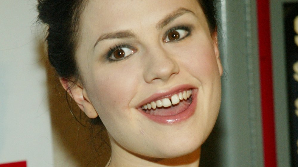 Celebs With The Worst Teeth