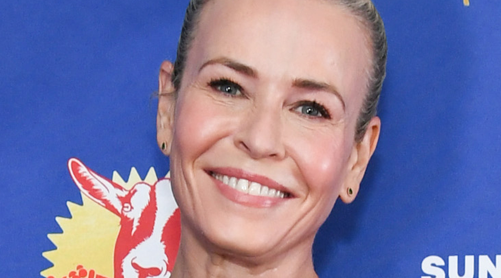 Chelsea Handler Reveals Injuries After Getting Into A Skiing Accident