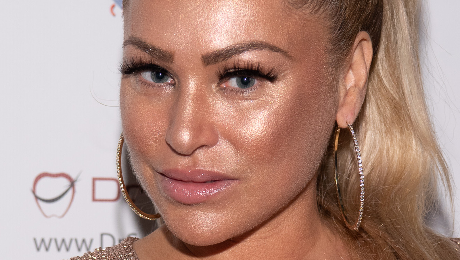 Darcey And Stacey: How Much Plastic Surgery Have The TLC Stars Had?