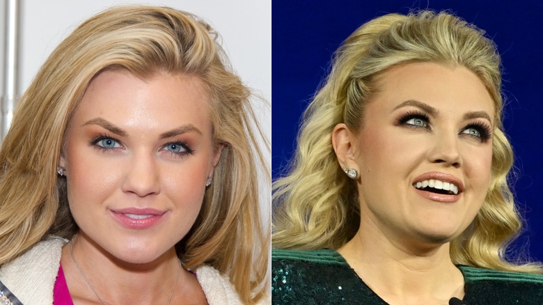 Plastic Surgeon Tells Us What Erika Kirk Has Done To Her Face To Get ...