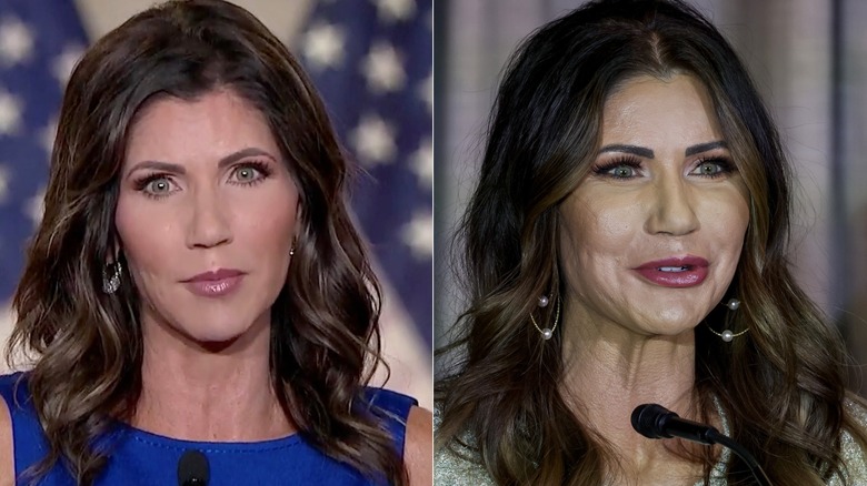Kristi Noem Can't Escape The Rampant Plastic Surgery Rumors Kristi Noem Can't Escape The Rampant Plastic Surgery Rumors