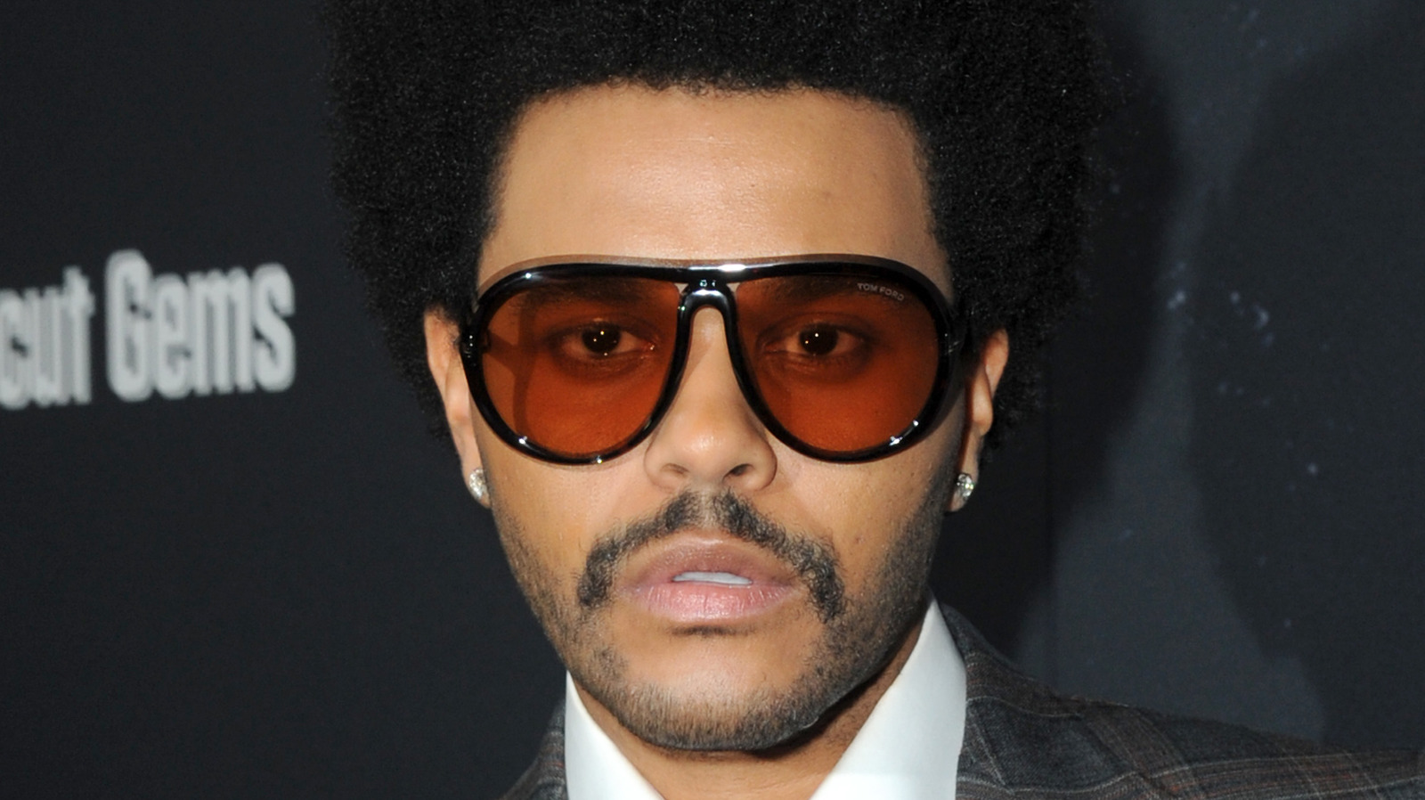 The Weeknd's Face: Here's What Really Happened