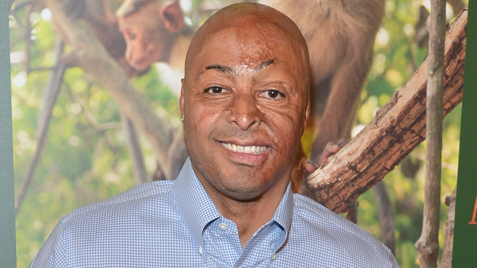 These Actors Might Be Famous Because Of Their Facial Scars These Actors Might Be Famous Because Of Their Facial Scars