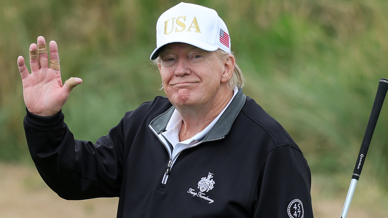 Trump's Unrecognizable Face Isn't Helping Raging Rumors About His Health