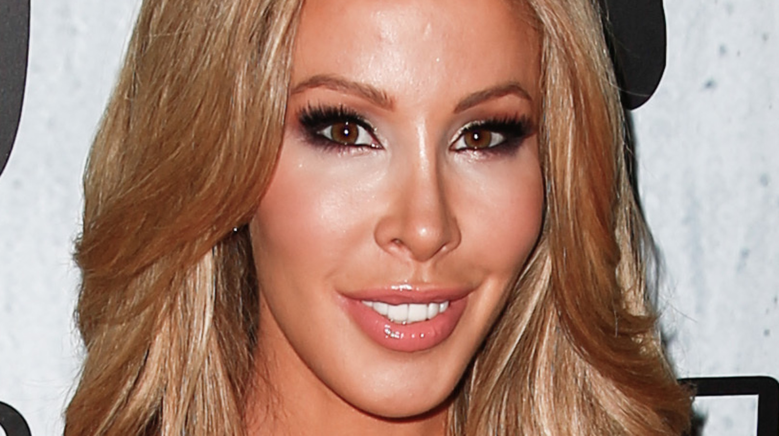 Why Is This Real Housewives Of Miami Star Removing Her Facial Fillers?