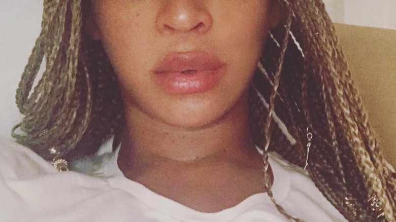 Rep For Beyonce Denies Lip Injection Rumors